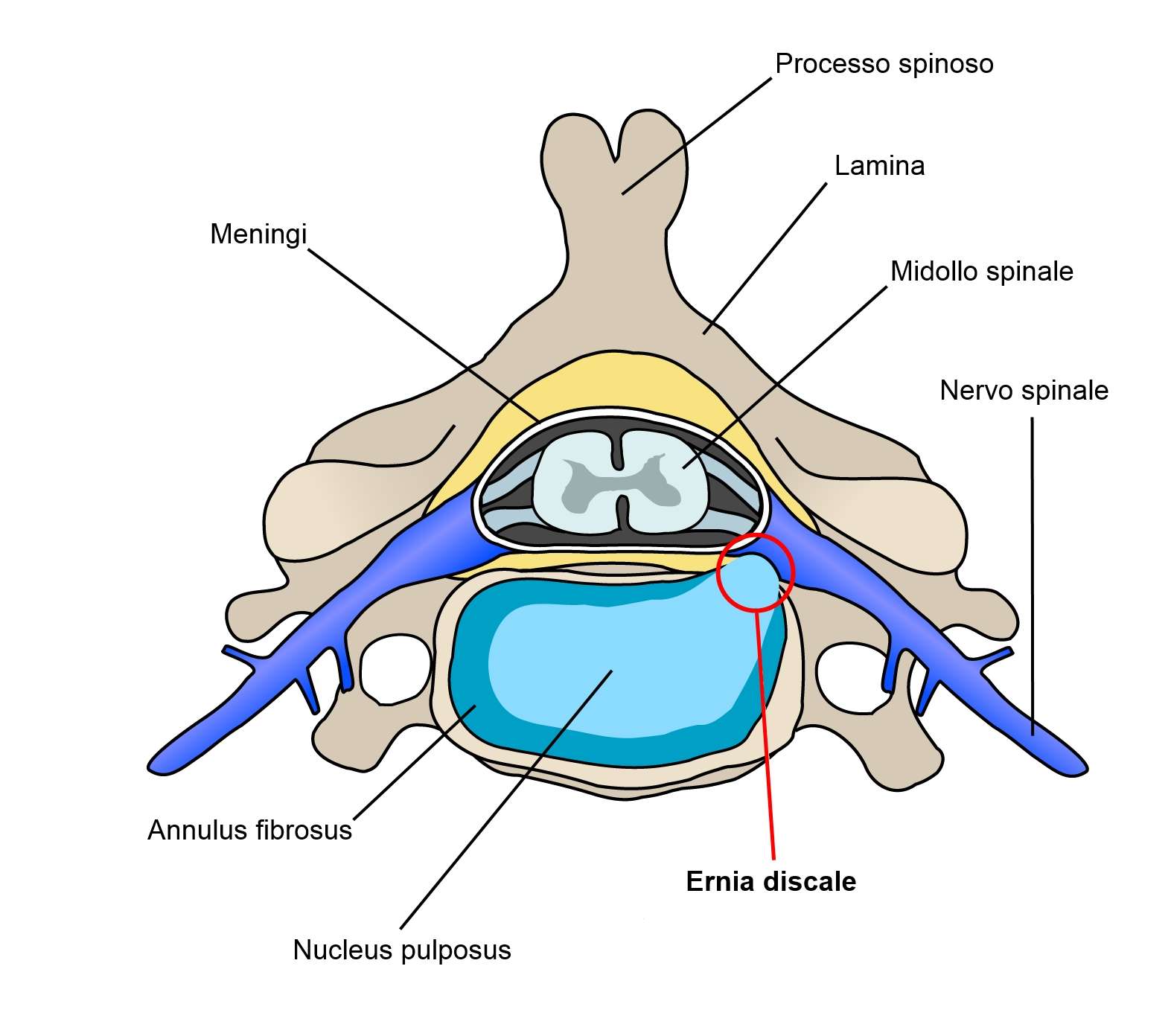 ERNIA DEL DISCO: "UN PUNTO DI VISTA SULLE POSSIBILI CAUSE" - Fisio Master